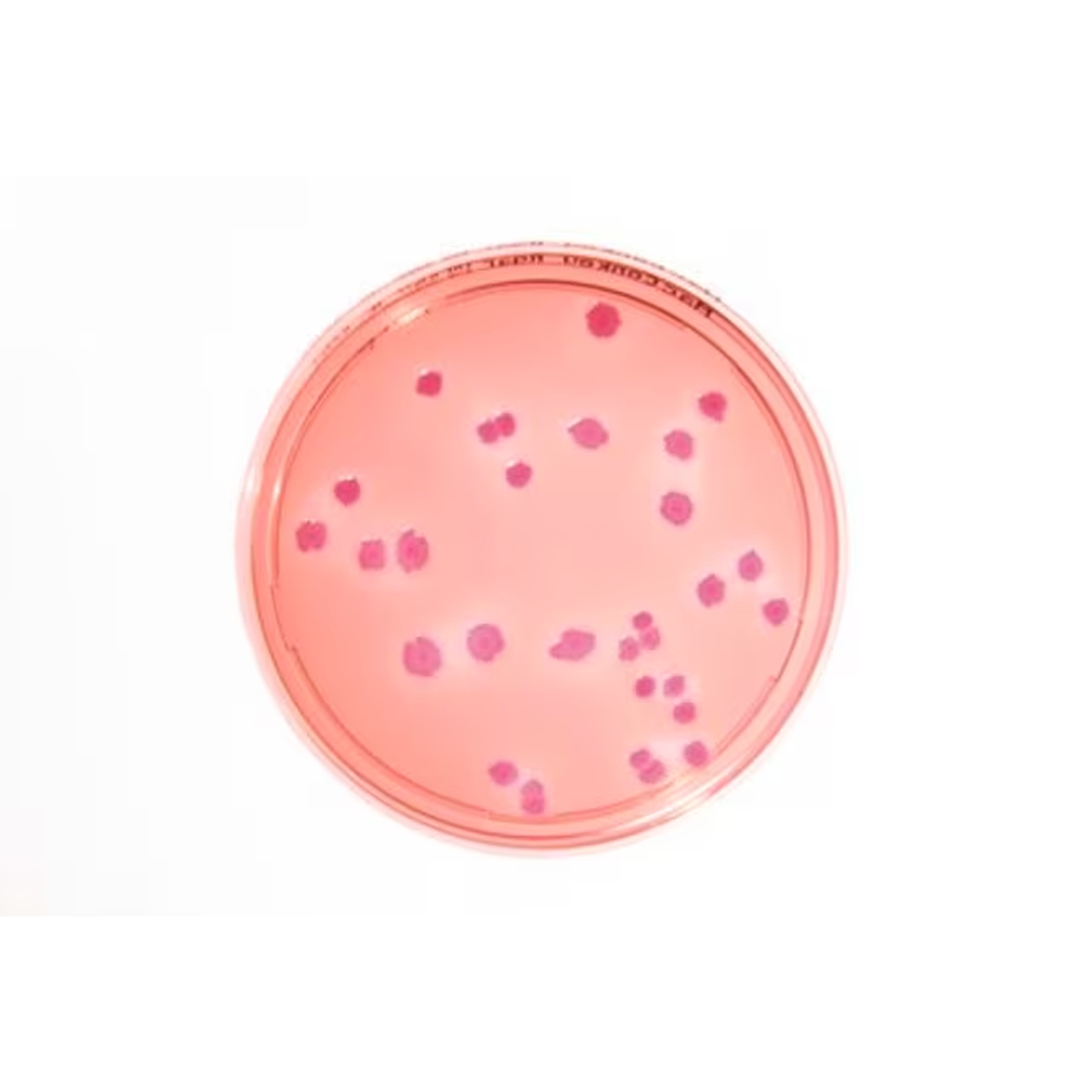 Settle agar plates – Vingmed